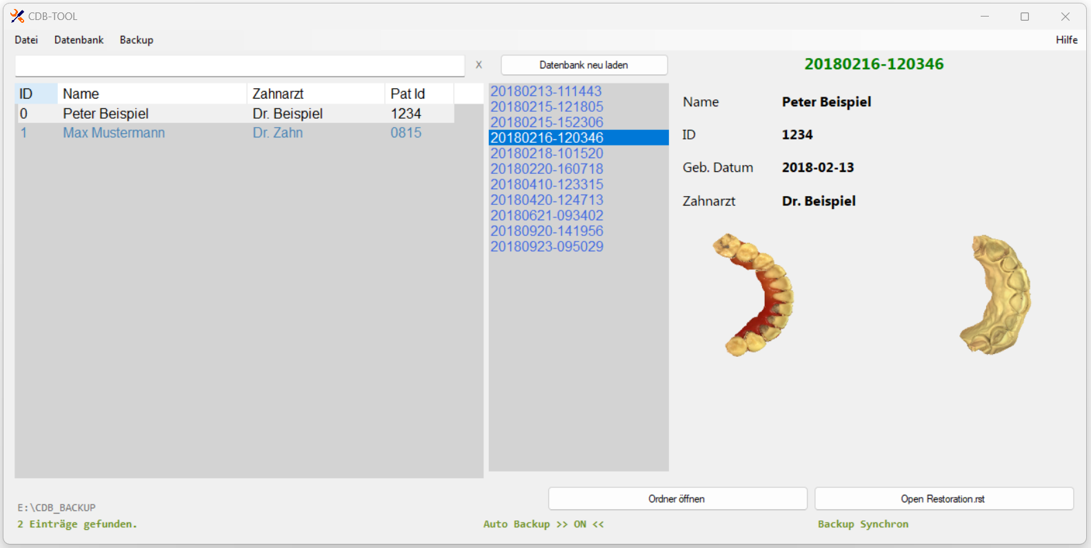 CDB-TOOL | denTool.Net Software